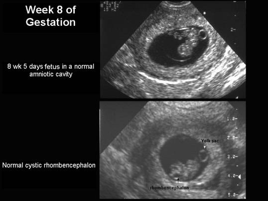 Week 8 Of Gestation